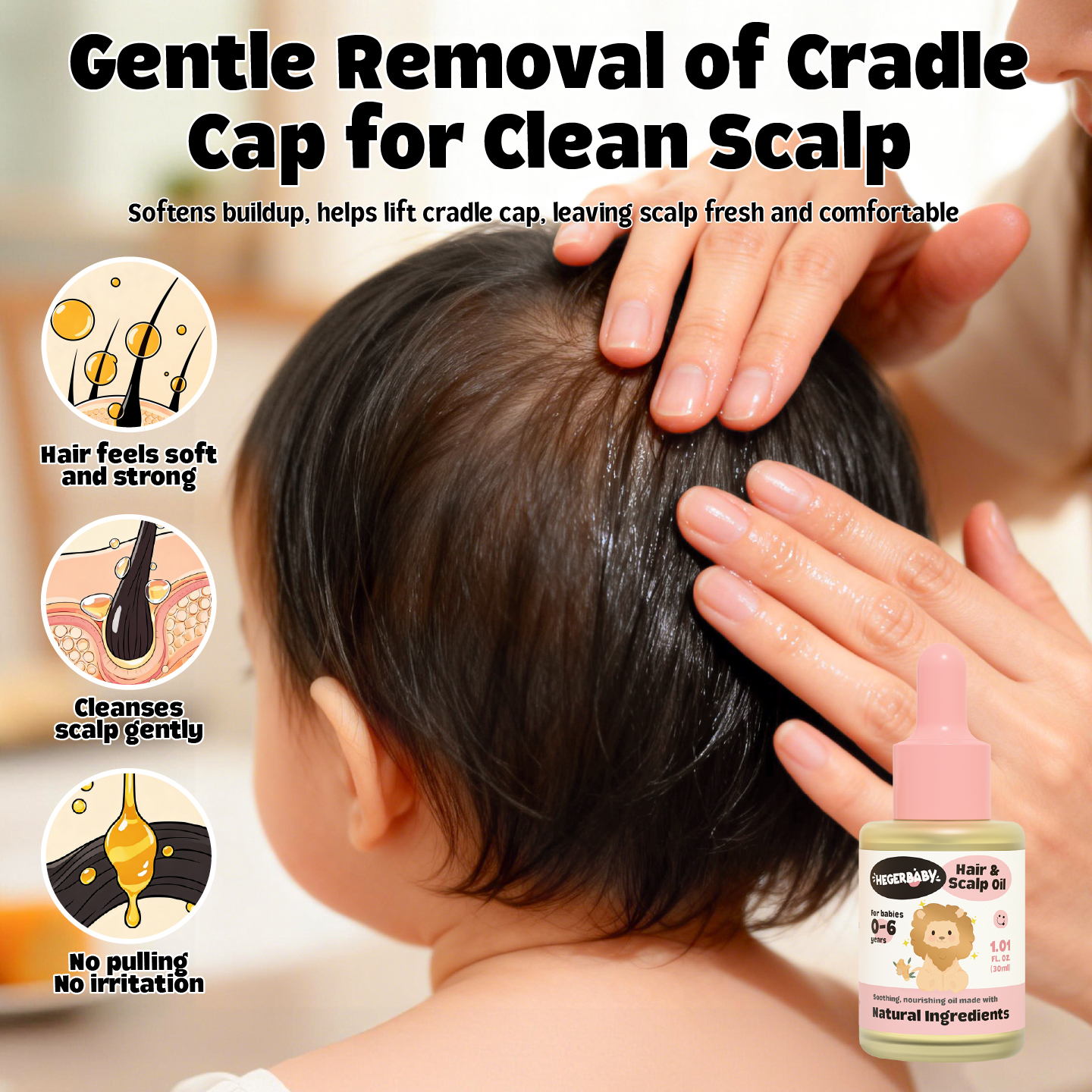 Hegerbaby Hair And Scalp Oil - Baby Oil Removes Cradle Cap Moisturizes ...