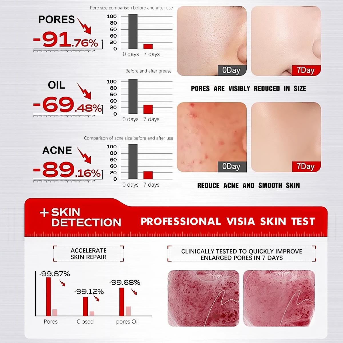 WORADA Skincare Gift Set 4-in-1 Brightening, Moister, Anti-Acne, Oil ...