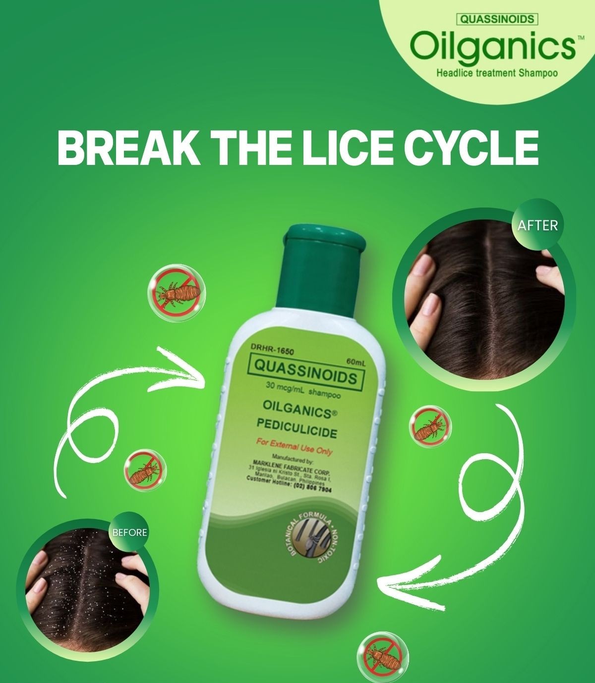 Oilganics Head Lice (Kuto) Treatment Shampoo | Shopee Philippines
