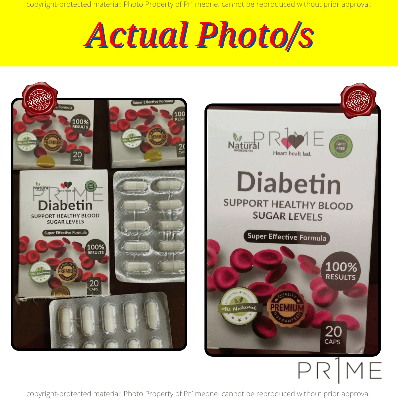Diabetin Capsule Original - Support Blood Sugar Levels | 1 Box = 20 ...