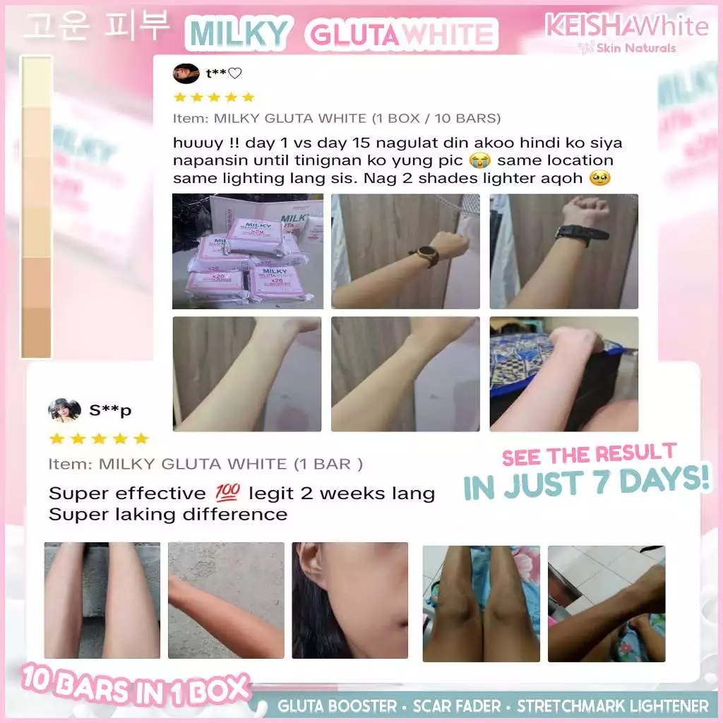 MILKY GLUTA WHITE SOAP x20 – Extreme Whitening Soap for Scar REMOVER ...
