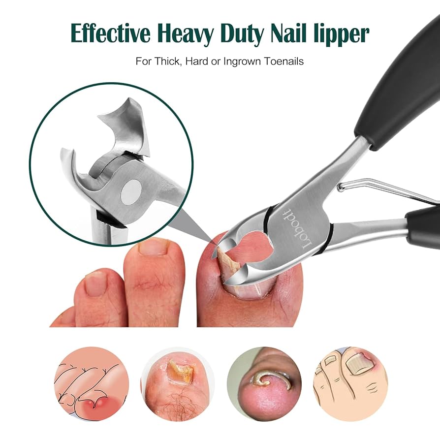 MEKMM Toe Nail Clippers Remove Dead Skin, Correction Nippers Ingrown ...