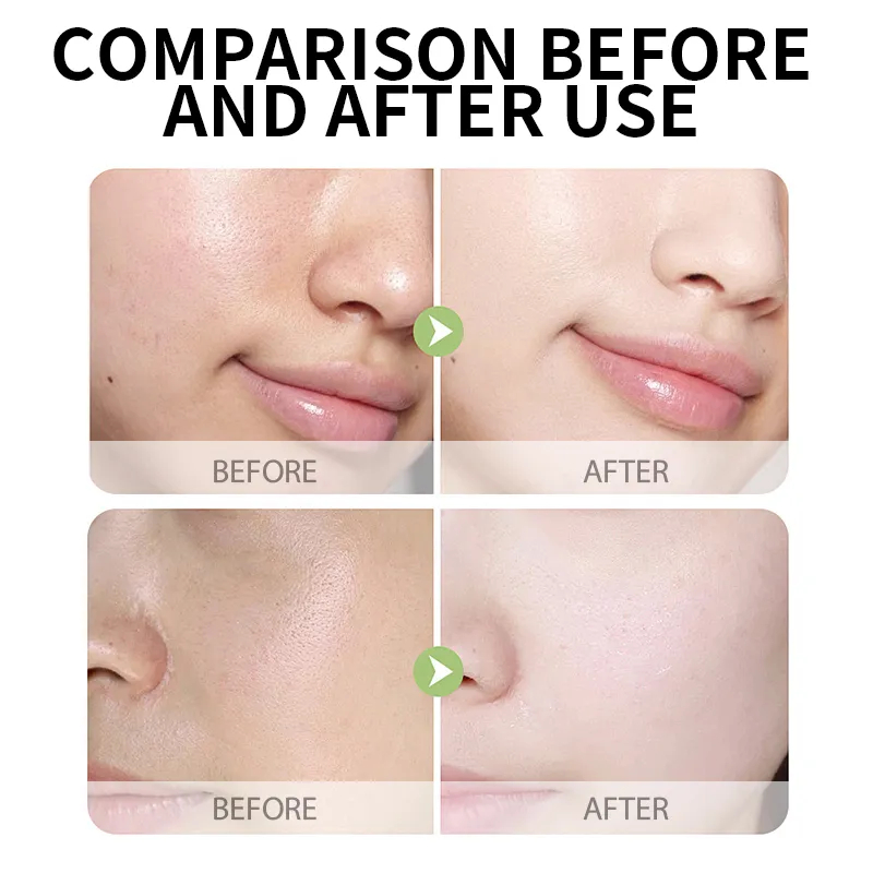 LBLS NIACINAMIDE Pure Serum Face and Body Moisturizes Whitening Skin ...
