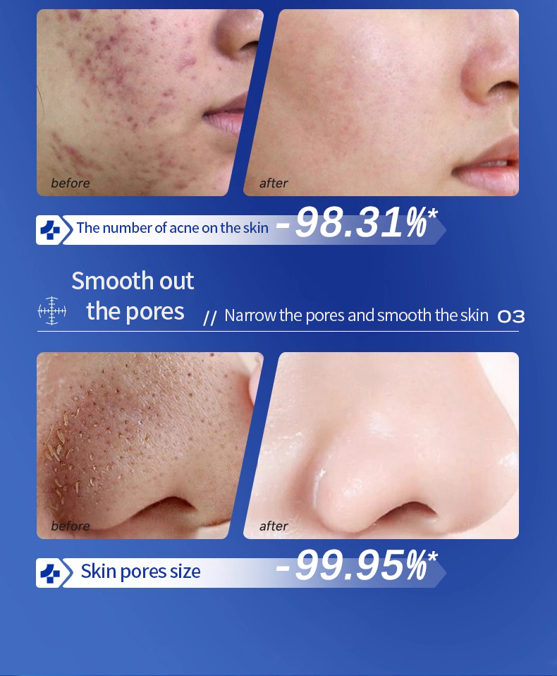 Dr.Lan Salicylic Acid Anti-acneFacialCleanser Oil Control Brightening ...