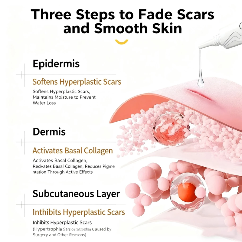 Contractubex The Scar gel that makes the Difference 30g From Germany ...