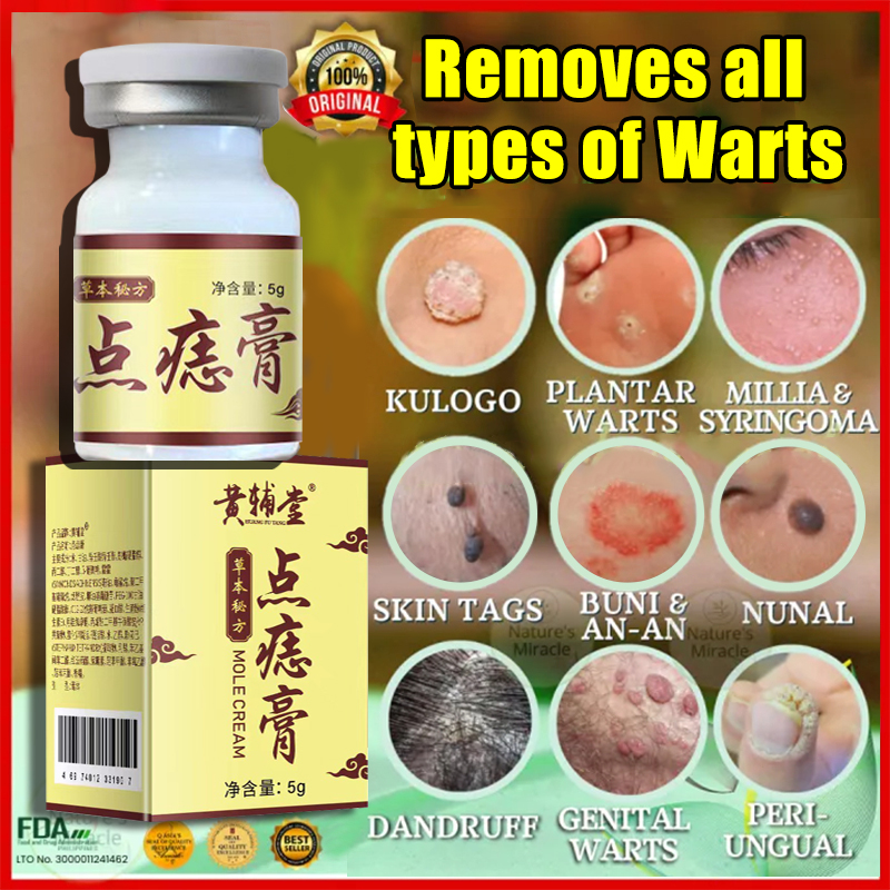 Concentrated potent skin tag removal cream Body Warts Cream Natures ...