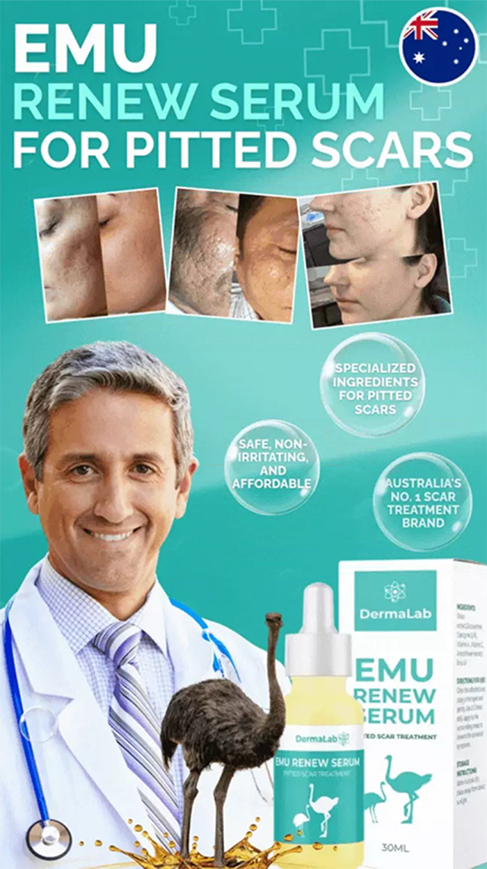 DermaLab Emu Renewal Serum (30ml) – Targeted Pitted Scar Repair, Deep ...