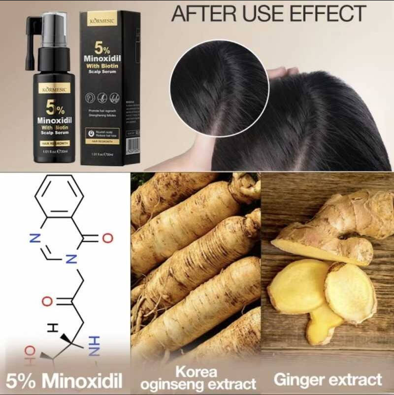 5% Minoxidil with Biotin Shampoo+Conditioner+Scalp seum for Hair ...