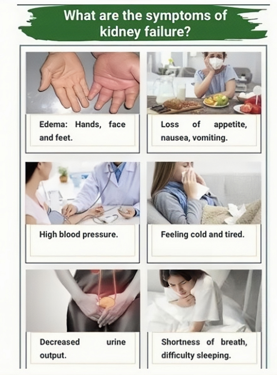 [BUY 1 TAKE 1] Neypro 1 Gold Colostrum Milk for Kidney Support And ...