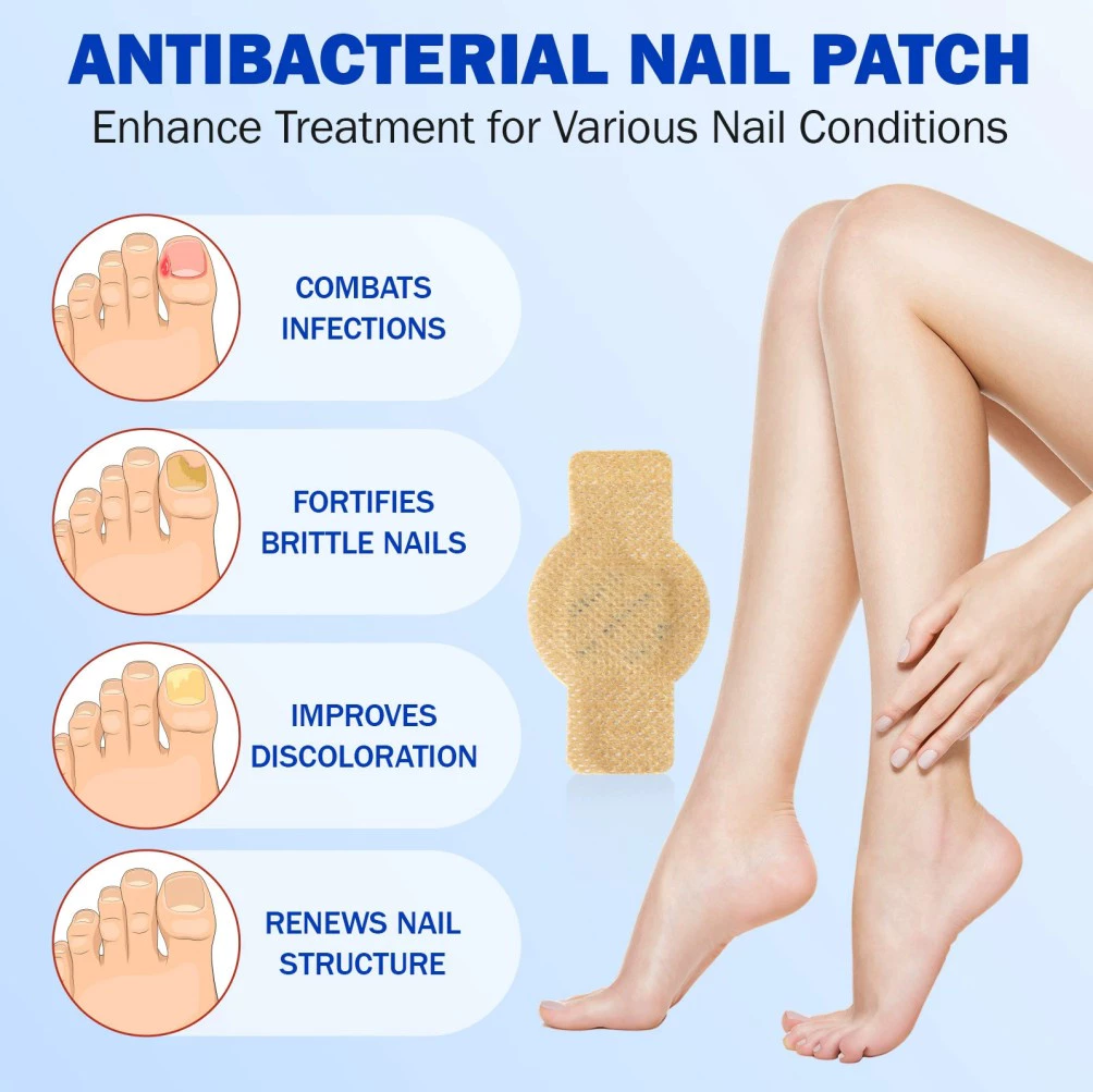 Fungal Nail Repair Patches Nail Fungus Treatment Toenail Care Overnight ...