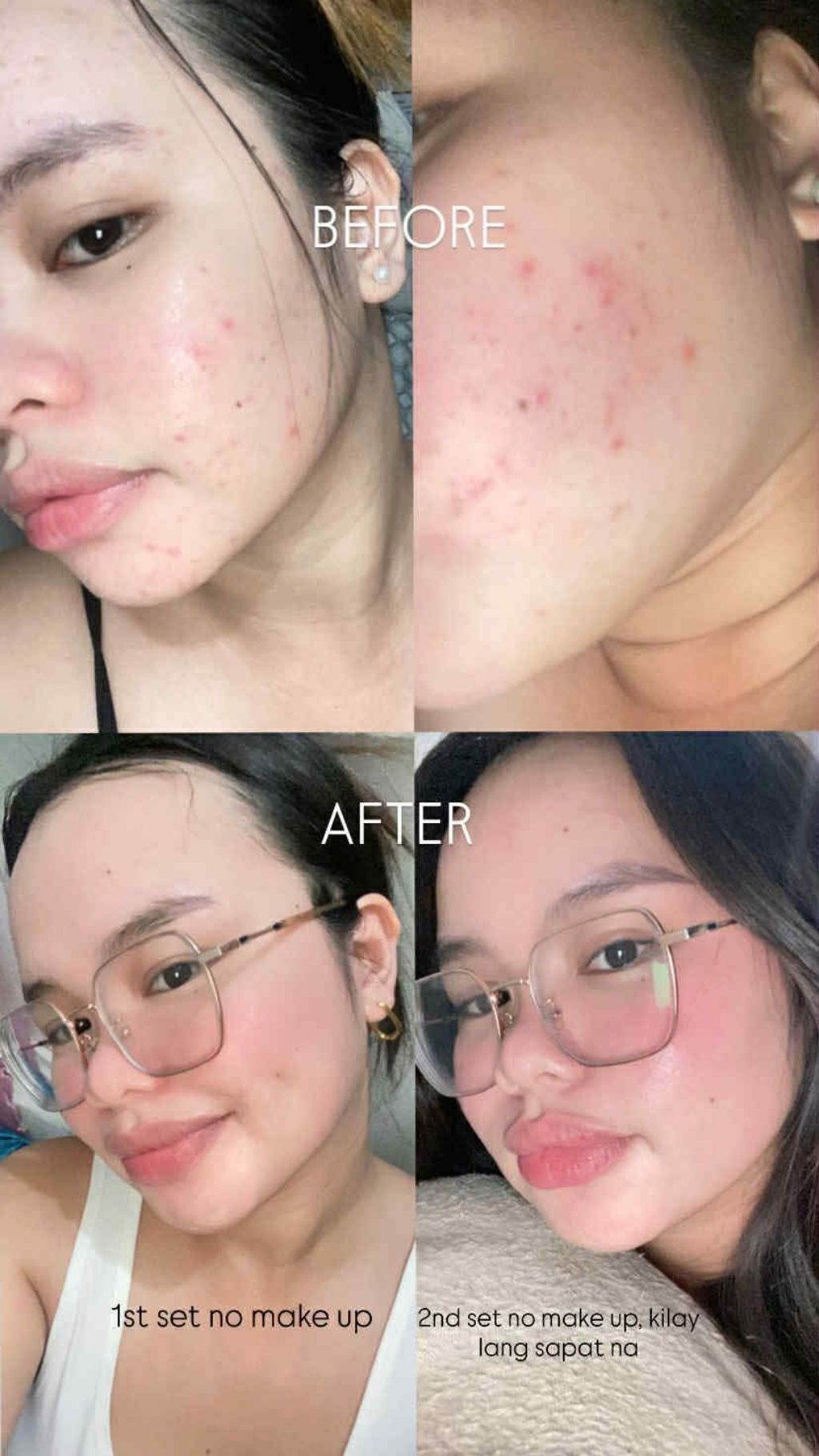 Hayami Skin Rejuvenating set | Shopee Philippines