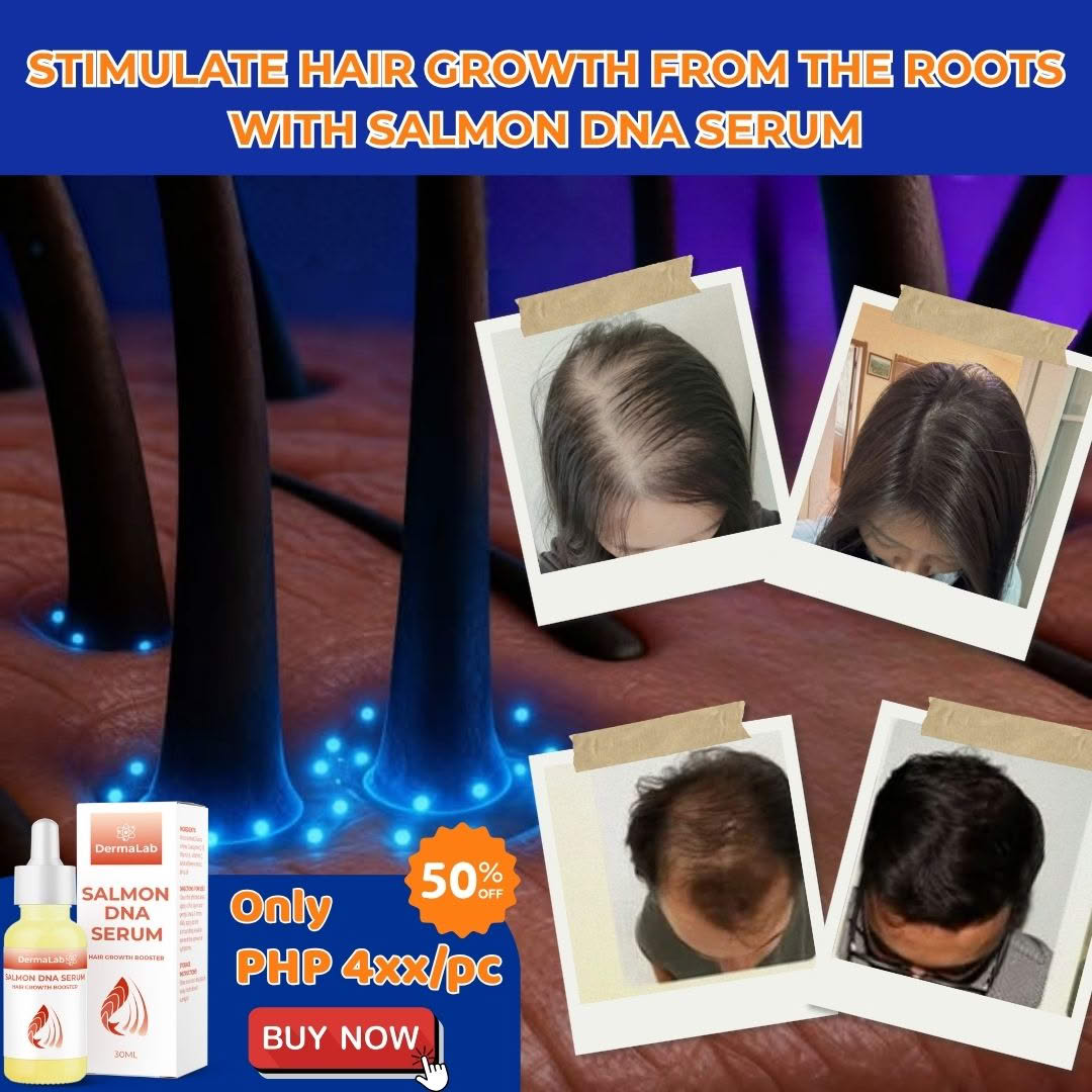 Dermalab - Salmon DNA Serum - Serum for hair loss treatment, stimulates ...