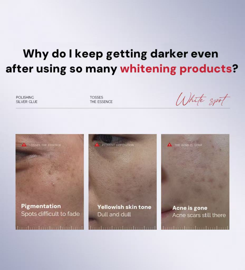 Legit Alpha Arbutin Whitening Serum Rejuvenating Moisturizing Hydrating ...