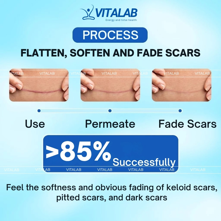 [BUY 1 GET 1] ACTISCAR 20G Scar Removal Cream - Smooth & Even Skin Tone ...