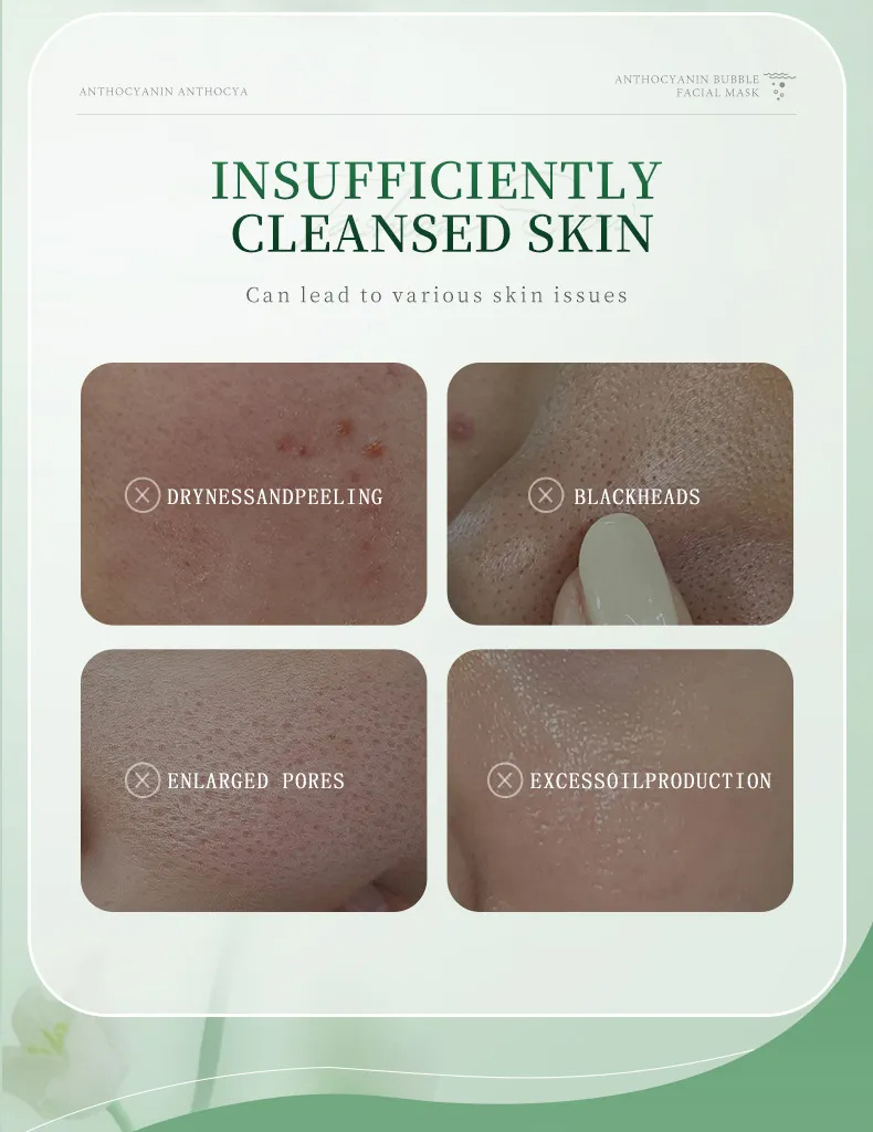 Anthocyanin Bubble Mask blackheads removal oil control facial Clean ...