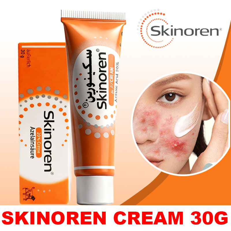 Skinoren 20% Cream 30g Anti Acne Scar Marks Remover Treatment For Face ...