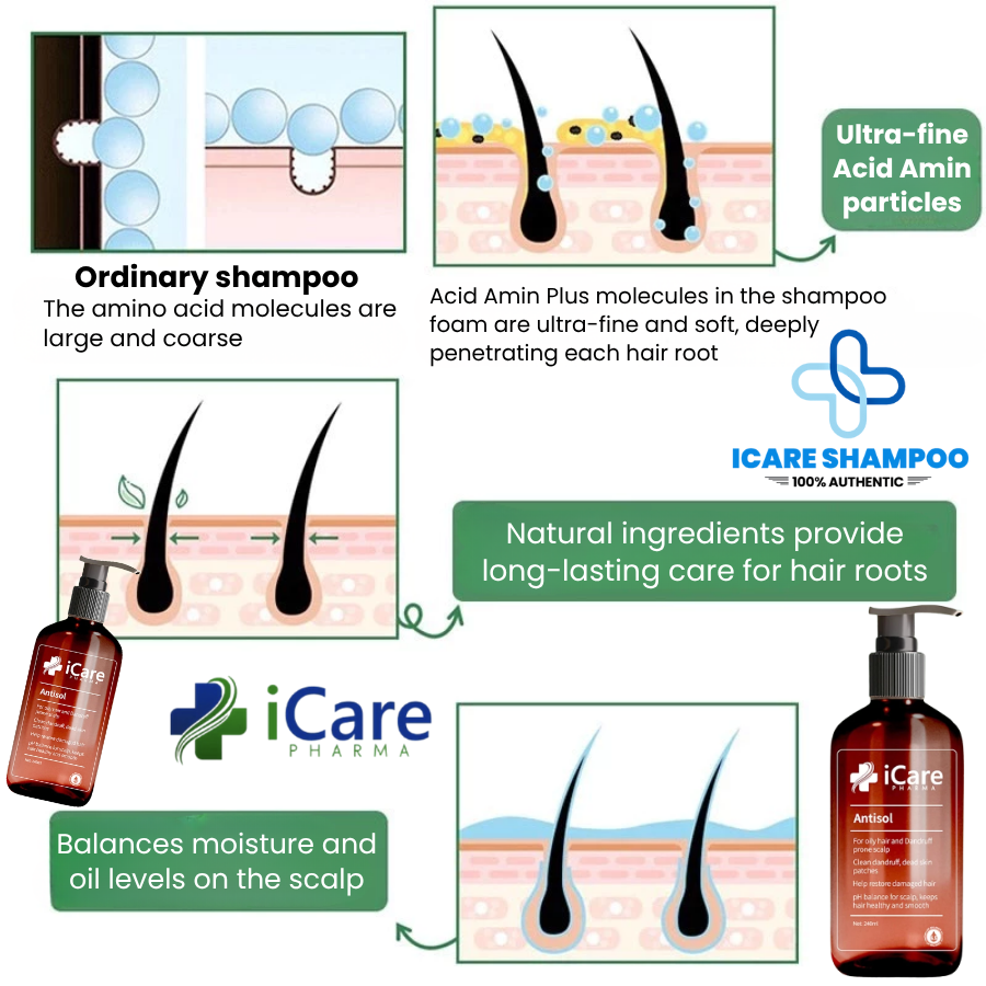 ICARE Antisol Shampoo - The Best Solution for Patchy Dandruff, Itchy ...