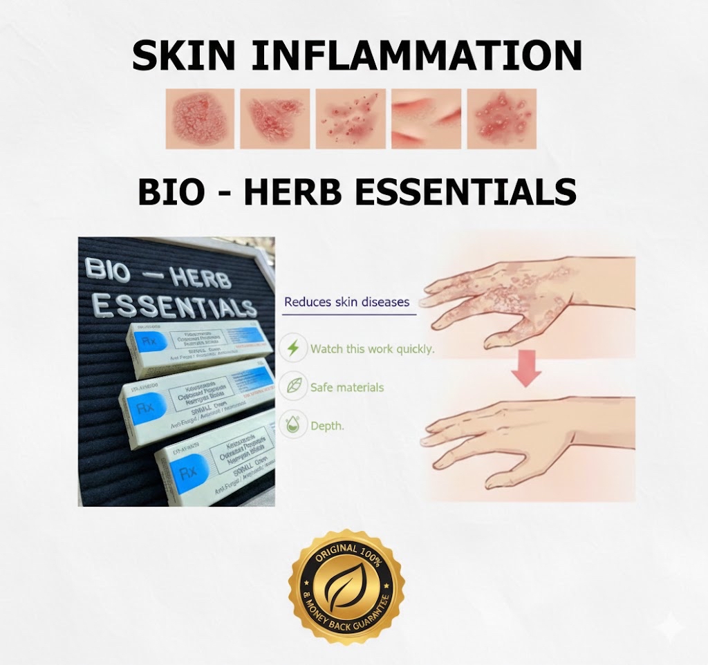 SKINALL HERBAL CREAM 10G AUTHENTIC MOISTURIZING SKIN FORMULA FOR ALL ...