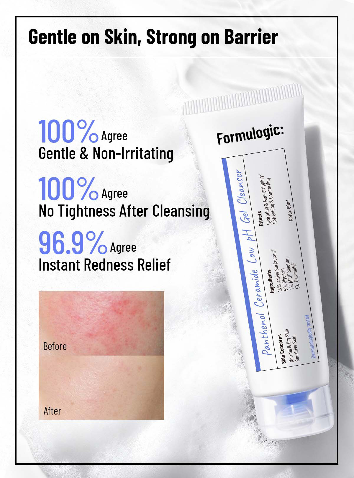 [Skin Emergency kit] Gentle Cleanser 80ml + SOS Cream 40ml | Breakouts ...