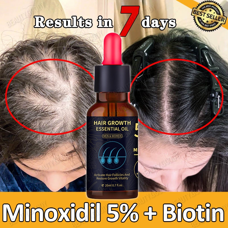 Minoxidil 5 Hair Grower Serum Biotin Minoxidil Hair Grower Original