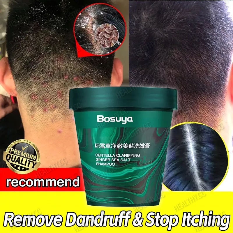 250g Sea salt shampoo anti dandruff shampoo Dandruff removal shampoo ...
