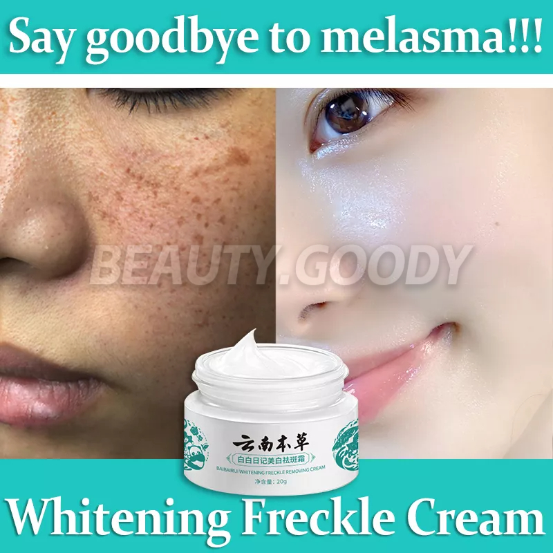 Melasma Cream Pekas Remover Original Collagen Pekas & Freckles Remover ...