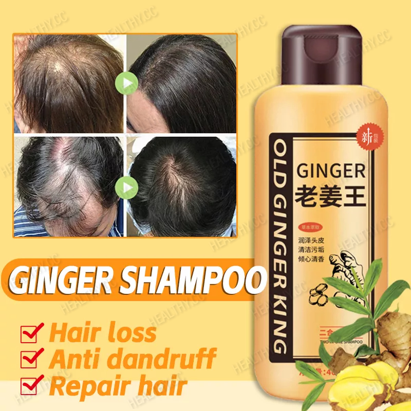 Ginger Shampoo Hair Growth Anti-dandruff Shampoo Anti Hair Loss Fast ...