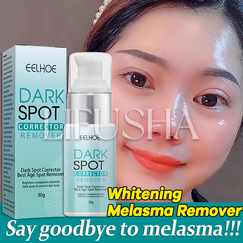 Melasma Cream Pekas Remover Original Collagen Pekas & Freckles Remover ...