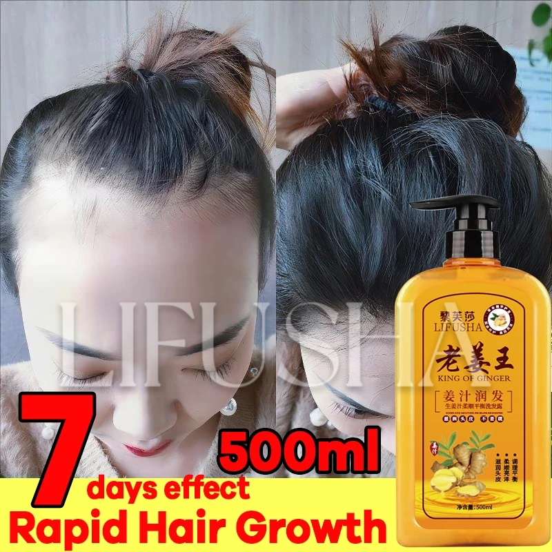 Ginger Hair Shampoo Fast Regrowth Hair Thick Anti-Hair Loss Anti ...