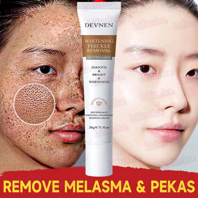 DEVNEN Melasma Cream Pekas Remover Nicotinamide Whitening Freckle Cream ...