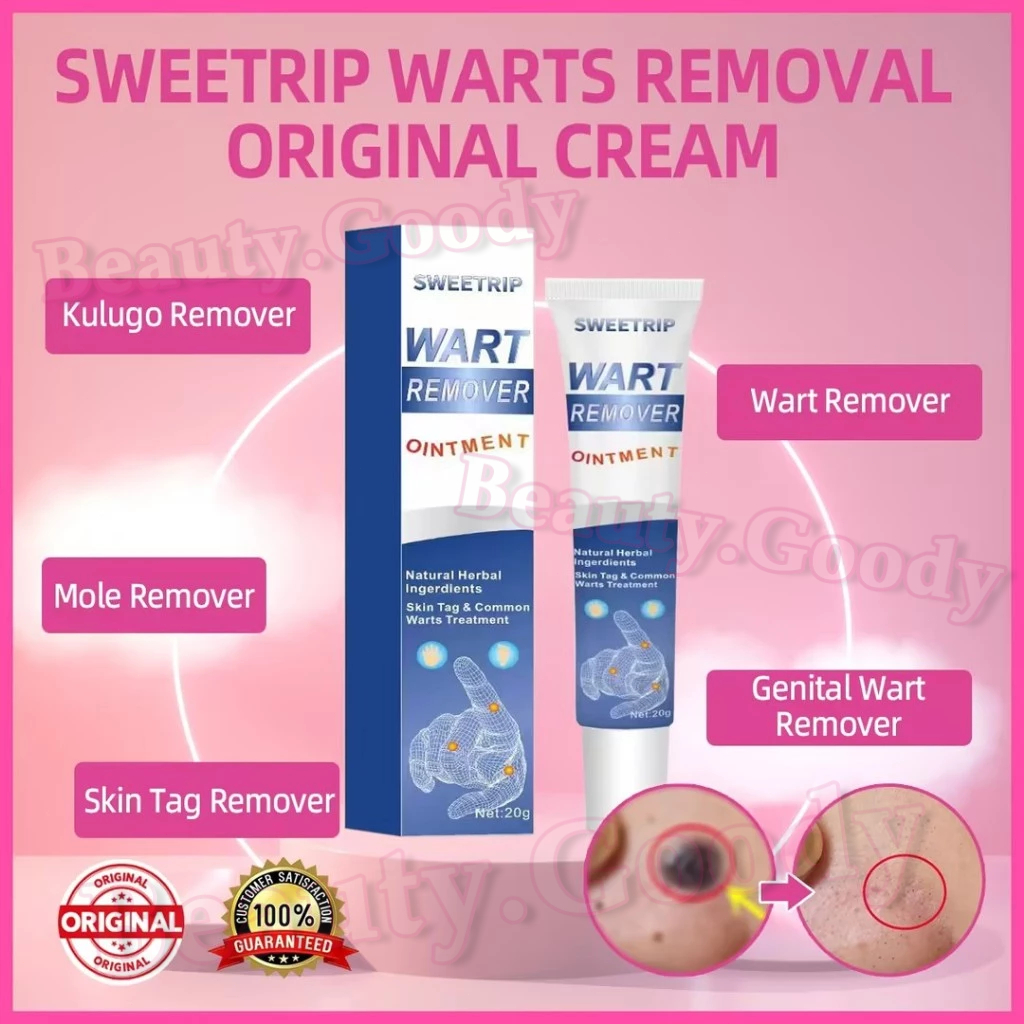 SWEETRIP Warts Remover Original Cream Kulugo Mole Skin Tags Nunal ...