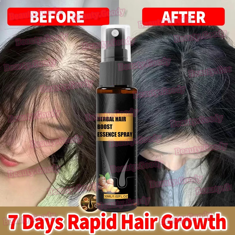 Ginger Hair Growth Serum Spray Rapid Hair Growth Anti Hair Loss Hair ...