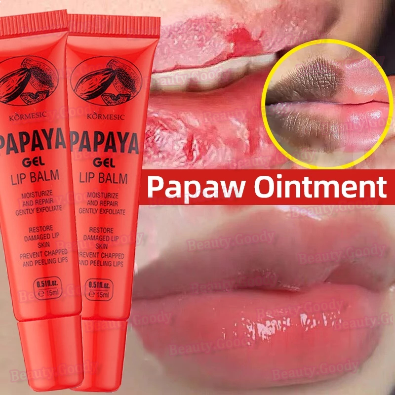 Original Papaw Ointment Papaya Lip Balm Burn Cream Mosquito Bites Acne ...
