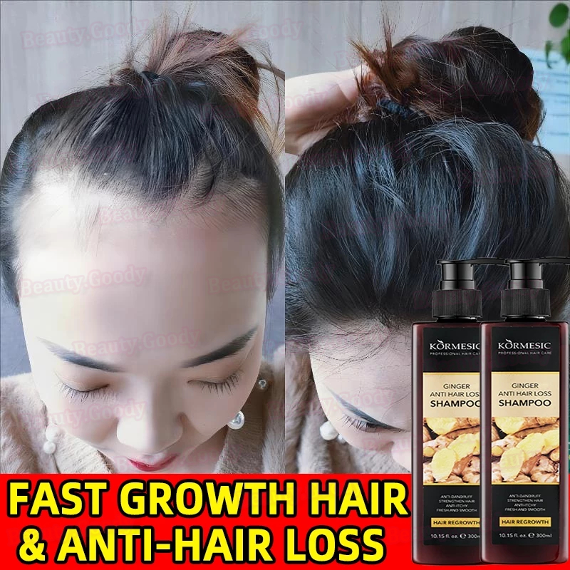 Ginger Shampoo Fast Regrowth Hair Thick Anti Dandruff Oil Control ...