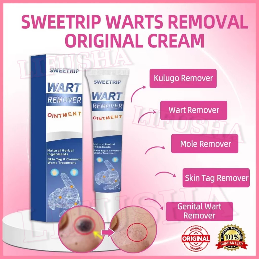 SWEETRIP Warts Remover Original Cream Kulugo Mole Skin Tags Nunal ...