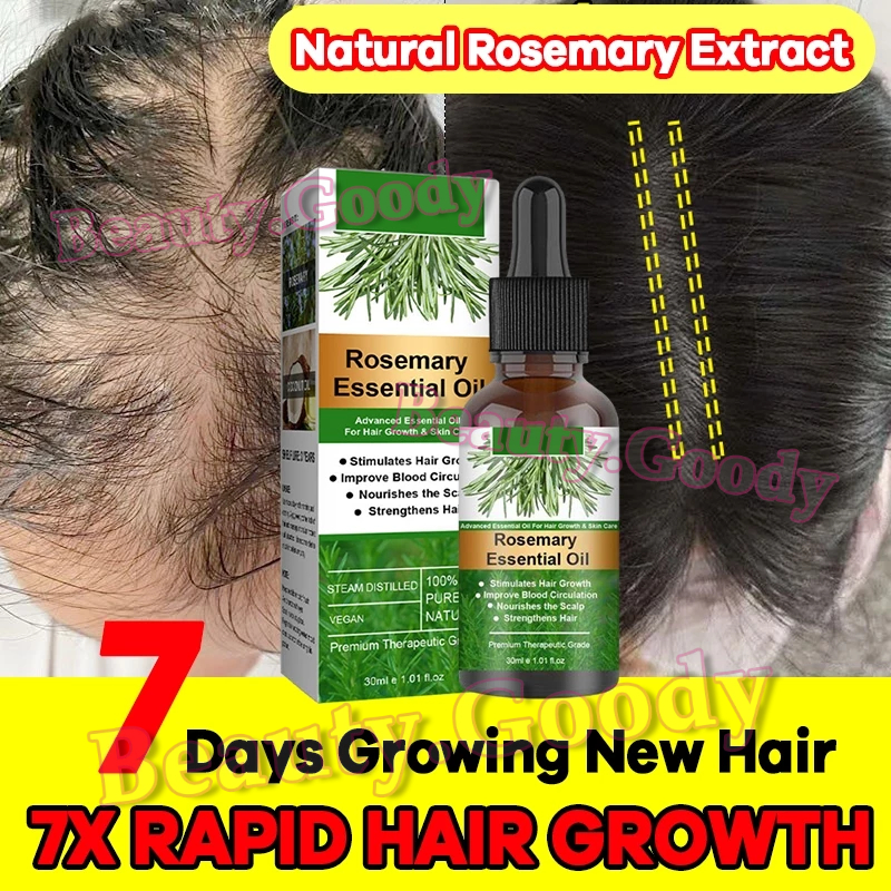 7X Rapid Growth Essence Anti Hair Loss Fast Hair Growth Rosemary ... 7X Rapid Growth Essence Anti Hair Loss Fast Hair Growth Rosemary ...