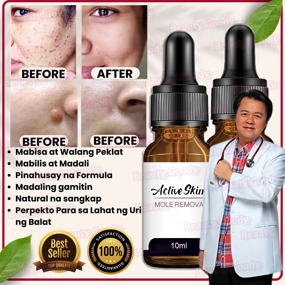 Warts Removal Original Oil Kulugo Skin Tags Mole Remover Common Warts ...