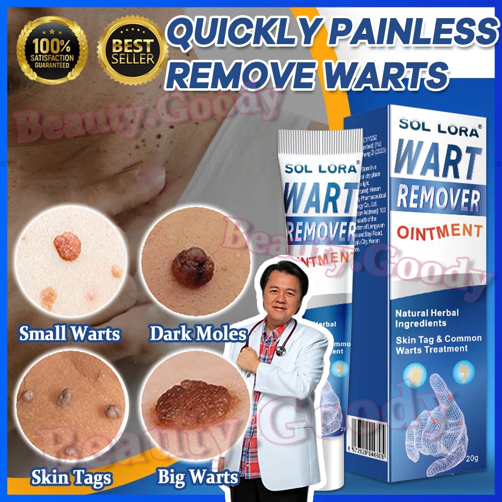 Warts Remover Cream Original Skin Tag Mole Remover Ointment Warts Cream ...