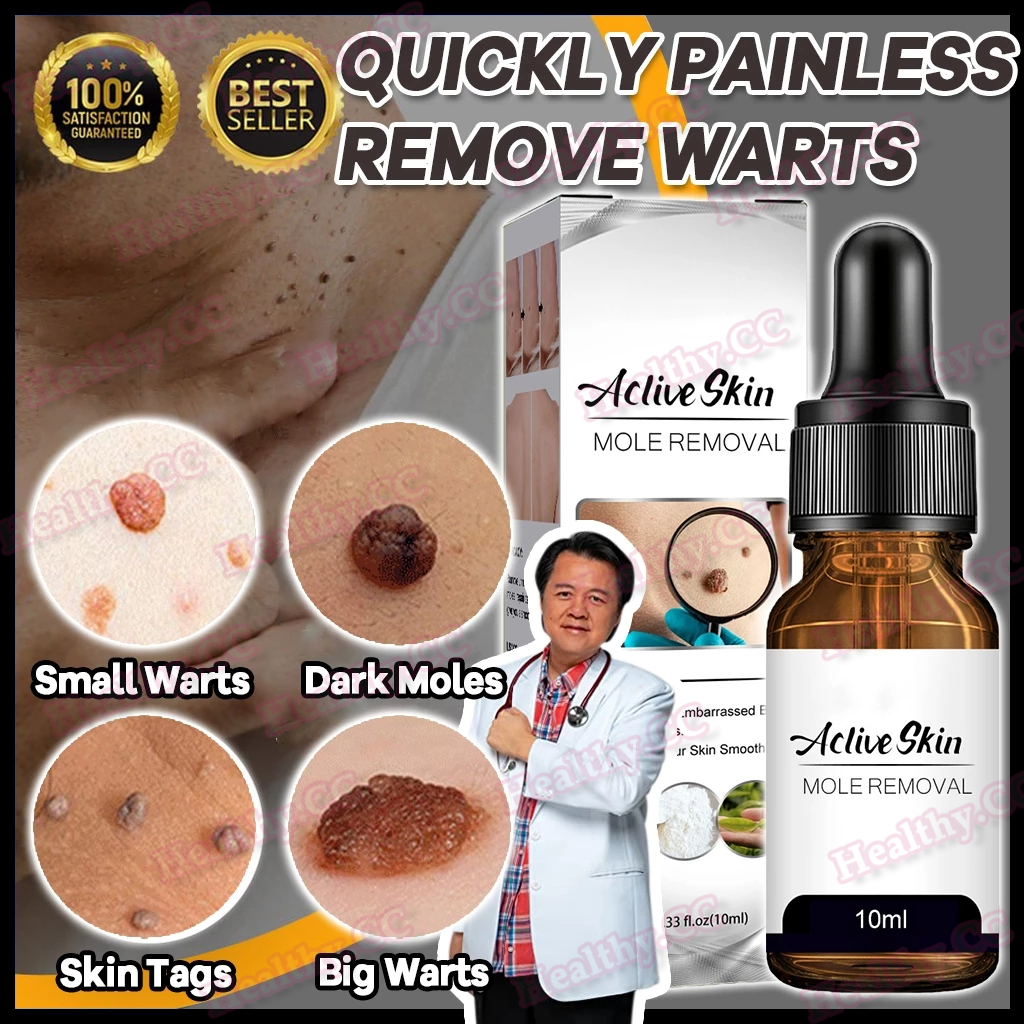 Warts Removal Original Oil Painless Warts Remover, Kulugo Remover, Skin ...