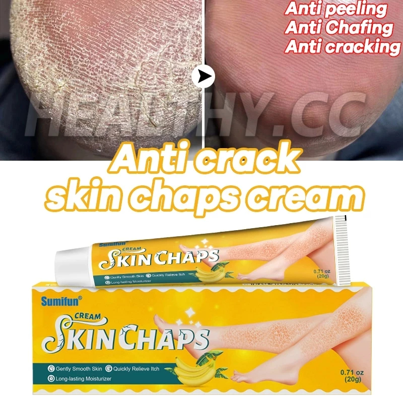 Anti Crack Foot Moisturizing Cream Skin Chaps Cream Anti-Cracking Anti ...