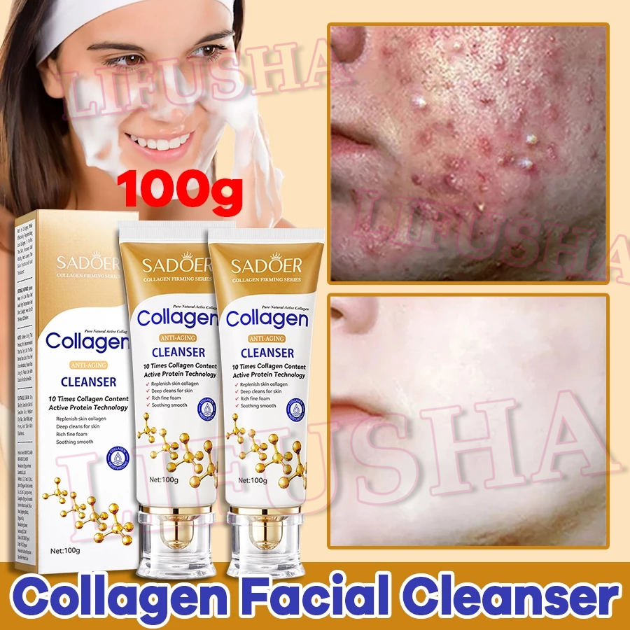 Collagen Cleanser Whitening Facial Wash 100g Anti Acne Remove Melasma ...