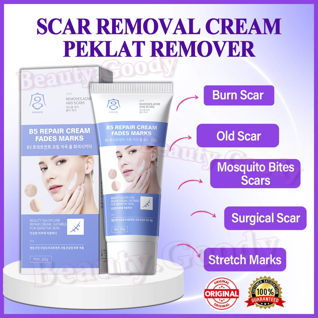 Scar Remover Cream Old Scar Effective Scarminator Cream Peklat Remover ...