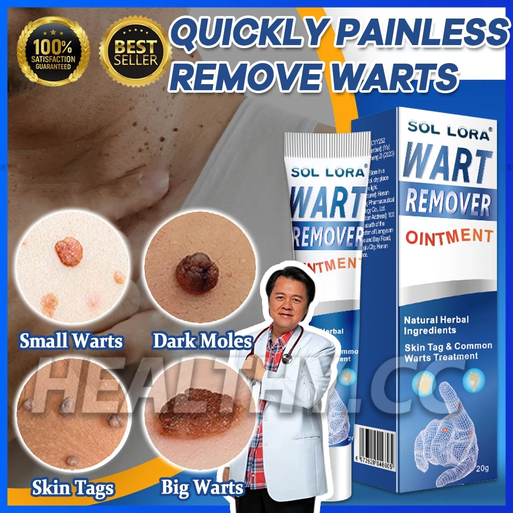 Warts Remover Original Cream Skin Tag Kulugo Mole Remover Cream Warts ...