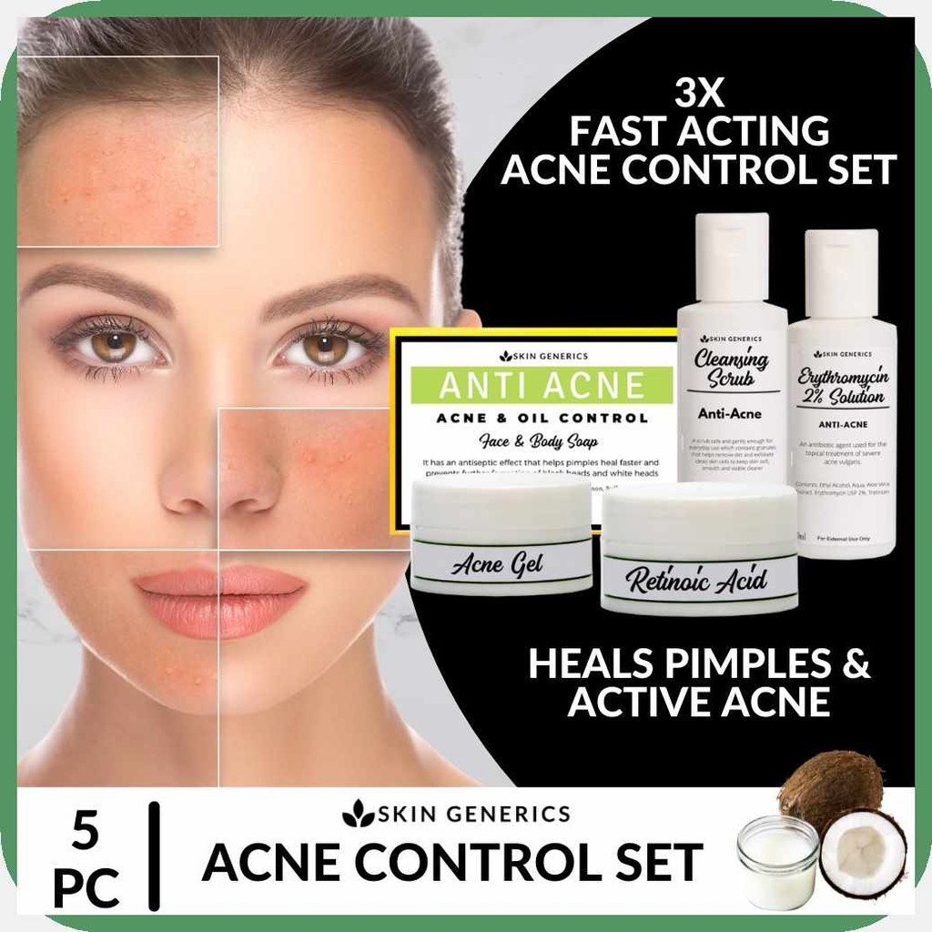 [ACNE;h]TREATMENT|b=tC#CONTROL(Q=SET](v=Skin(E=Generics(J=Acne(S ...