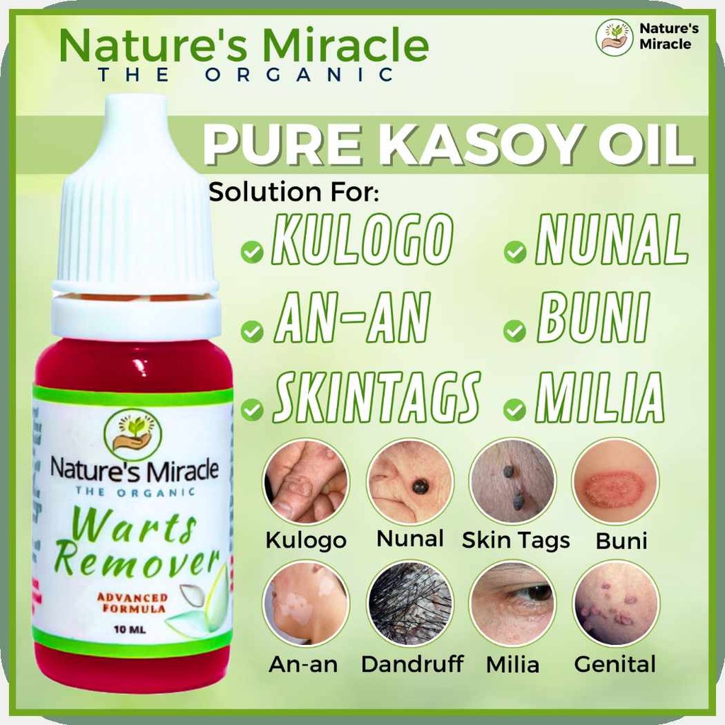 Warts*UI>remover'Ay/original~Ww?kasoy*VI?oil*Be?kasoy*mi?oil*le?wart*Qc ...
