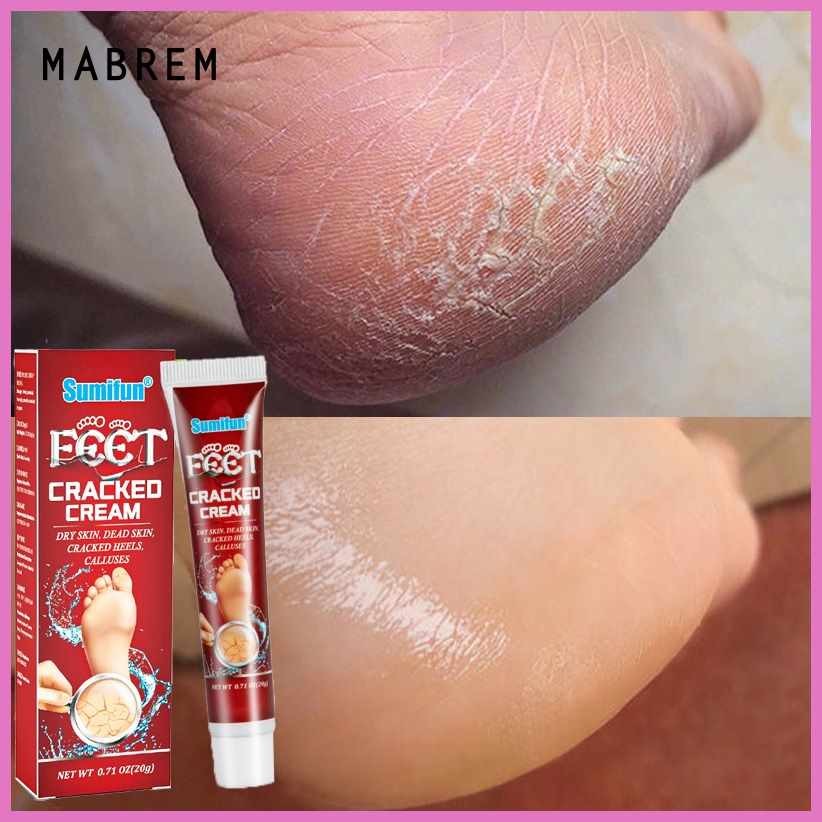 【2024】Cracked?Fxvw%Heel~Ct?Cream*VO?Foot*ON?Care*OH?Hand+D@Cream+h ...