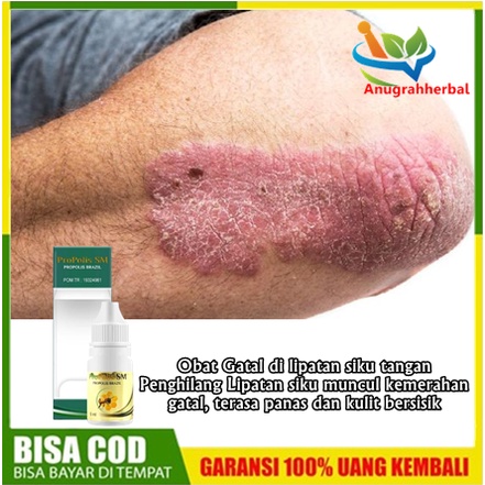 Elbow Itching Medicines, Elbow Folds, Reducing Itching, Itching ...