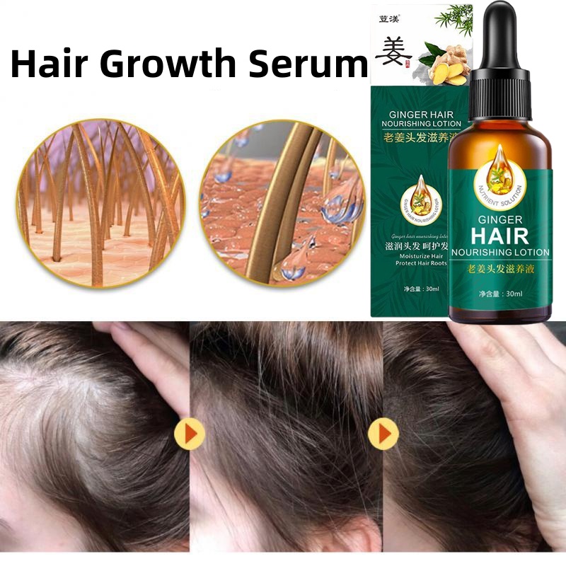 Hair Growth Serum Ginger Hair Treatment Essence Anti Hair Loss Spray ...