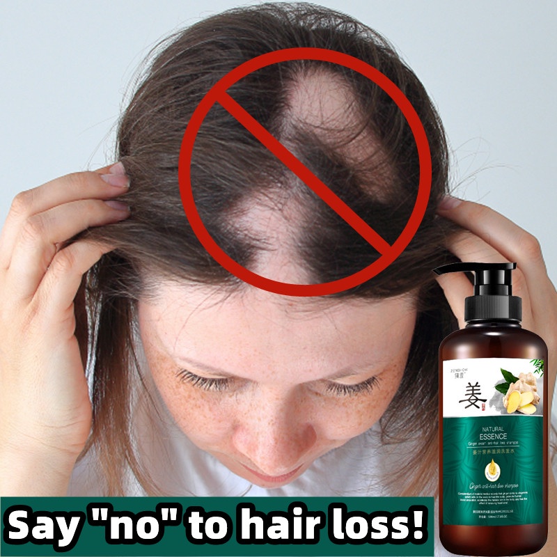 Ginger shampoo scalp treatment anti alopecia promote hair growth ...