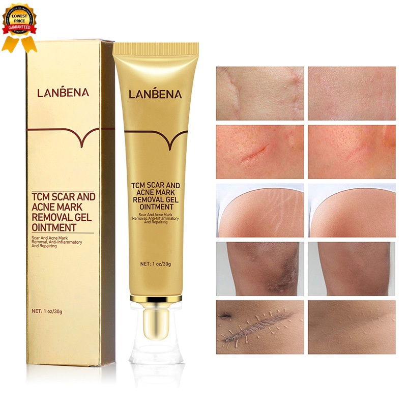 Original Labena TCM Scar And Acne Mark Removal Gel Ointment MENGHENG ...